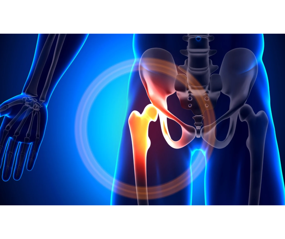 Understanding Hip Pain: Common Causes and Effective Solutions – Tay ...